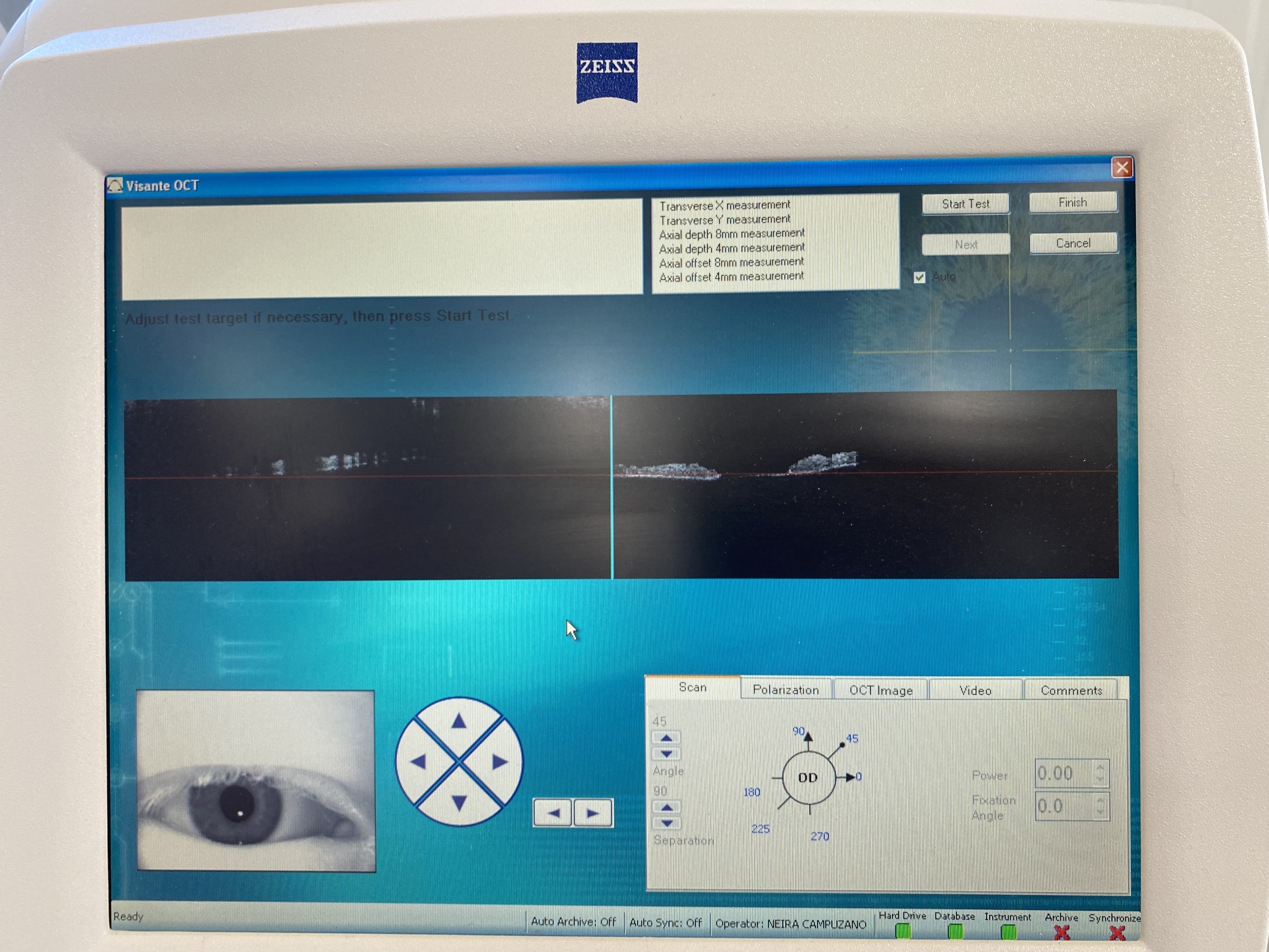 Carl Zeiss 1000 Visante OCT Anterior Segment Imaging - Medsold