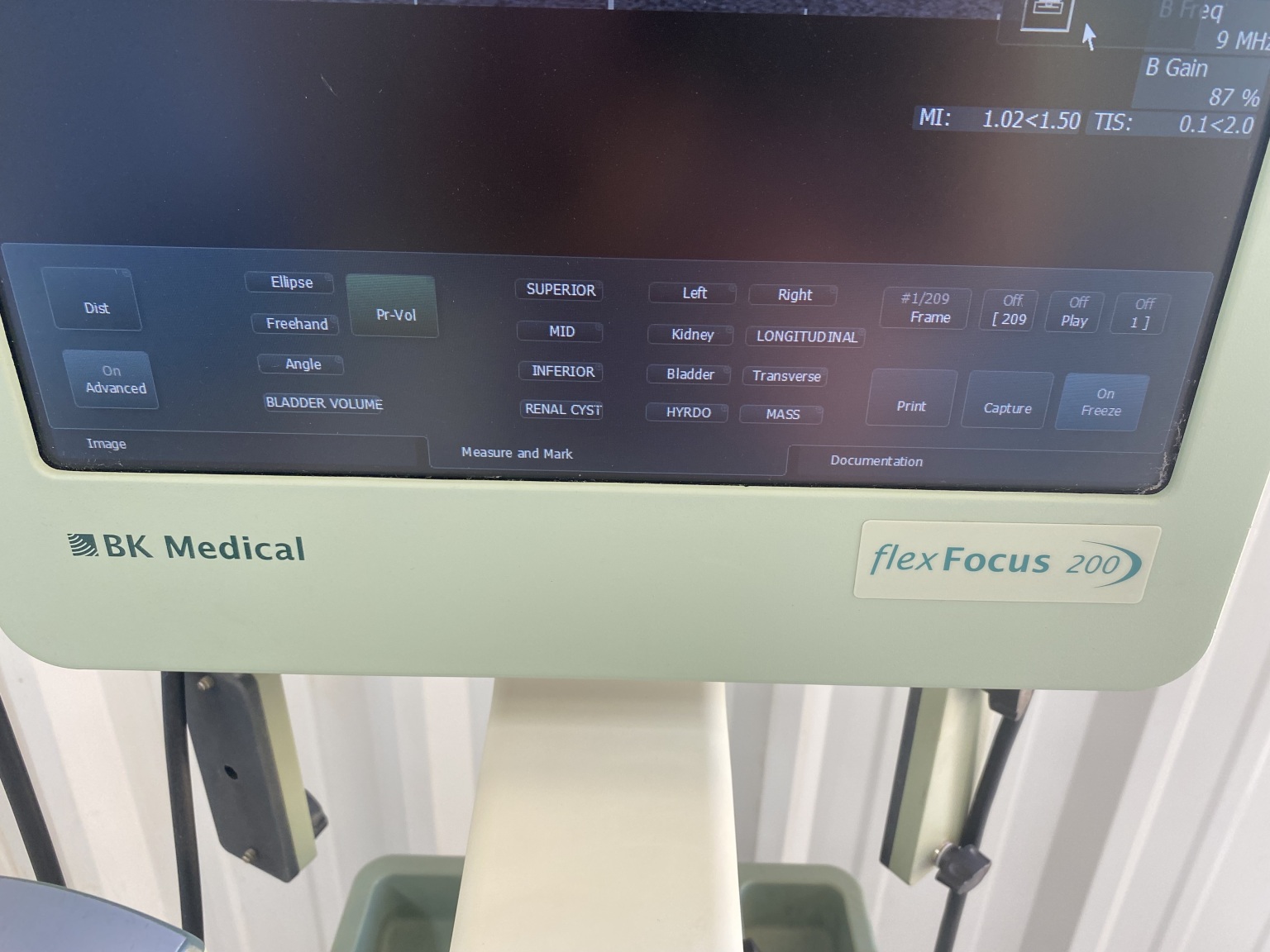 BK Medical Ultrasound Scanner 1202 Flex Focus 200 REF: Type 1202 - Medsold