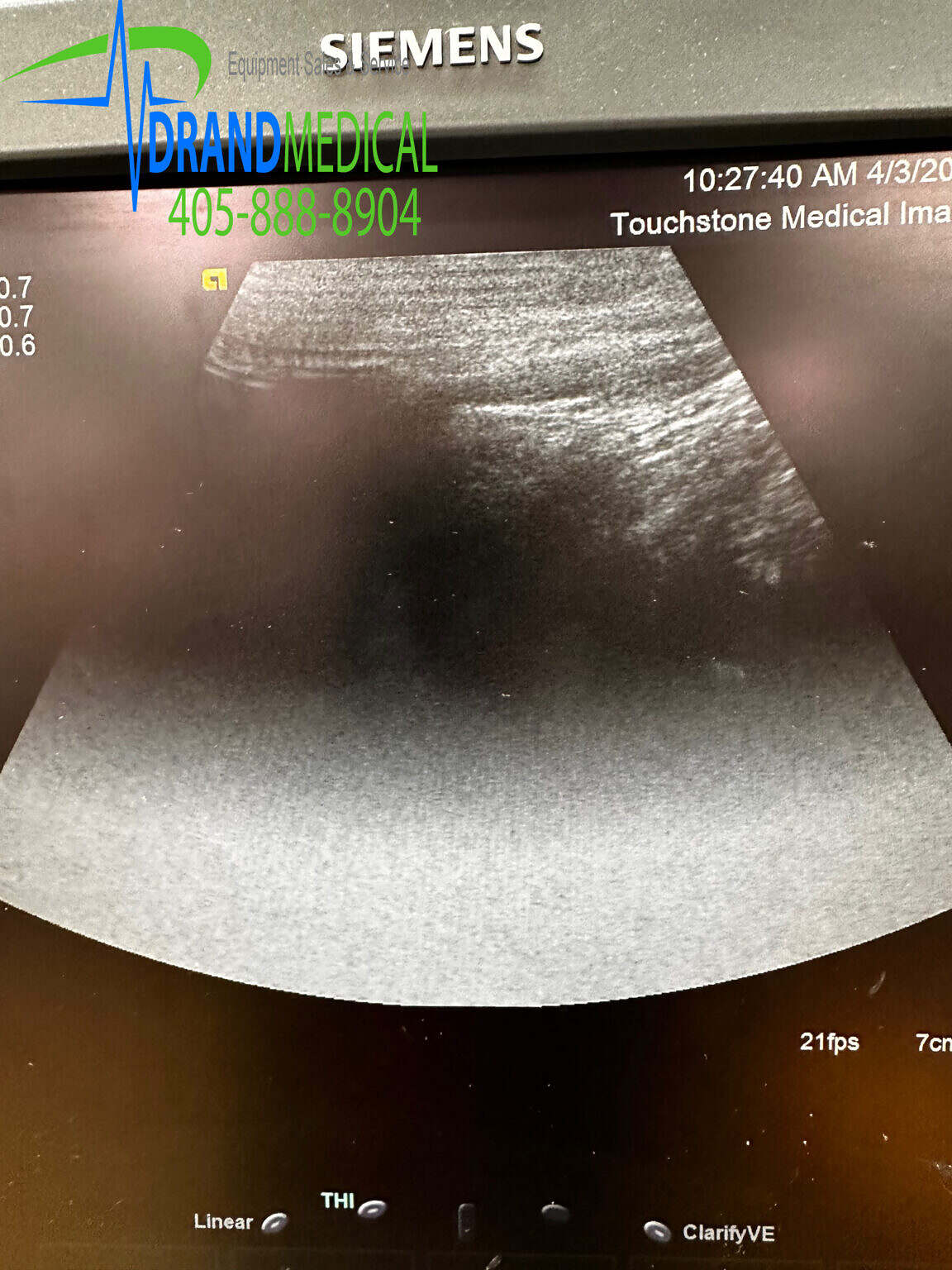 Siemens Acuson S2000 Ultrasound System 4C1 & EV-8C4 & 9L4 Probes - Medsold