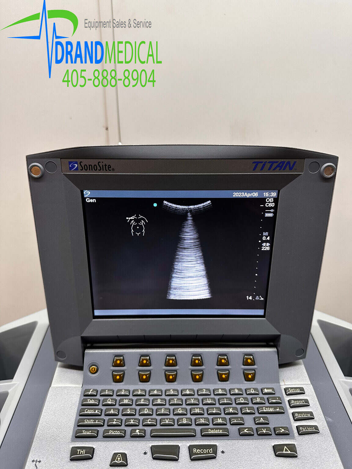 Sonosite Titan Ultrasound W/ICT/8-5 & C60/5-2 Probes & Triple ...