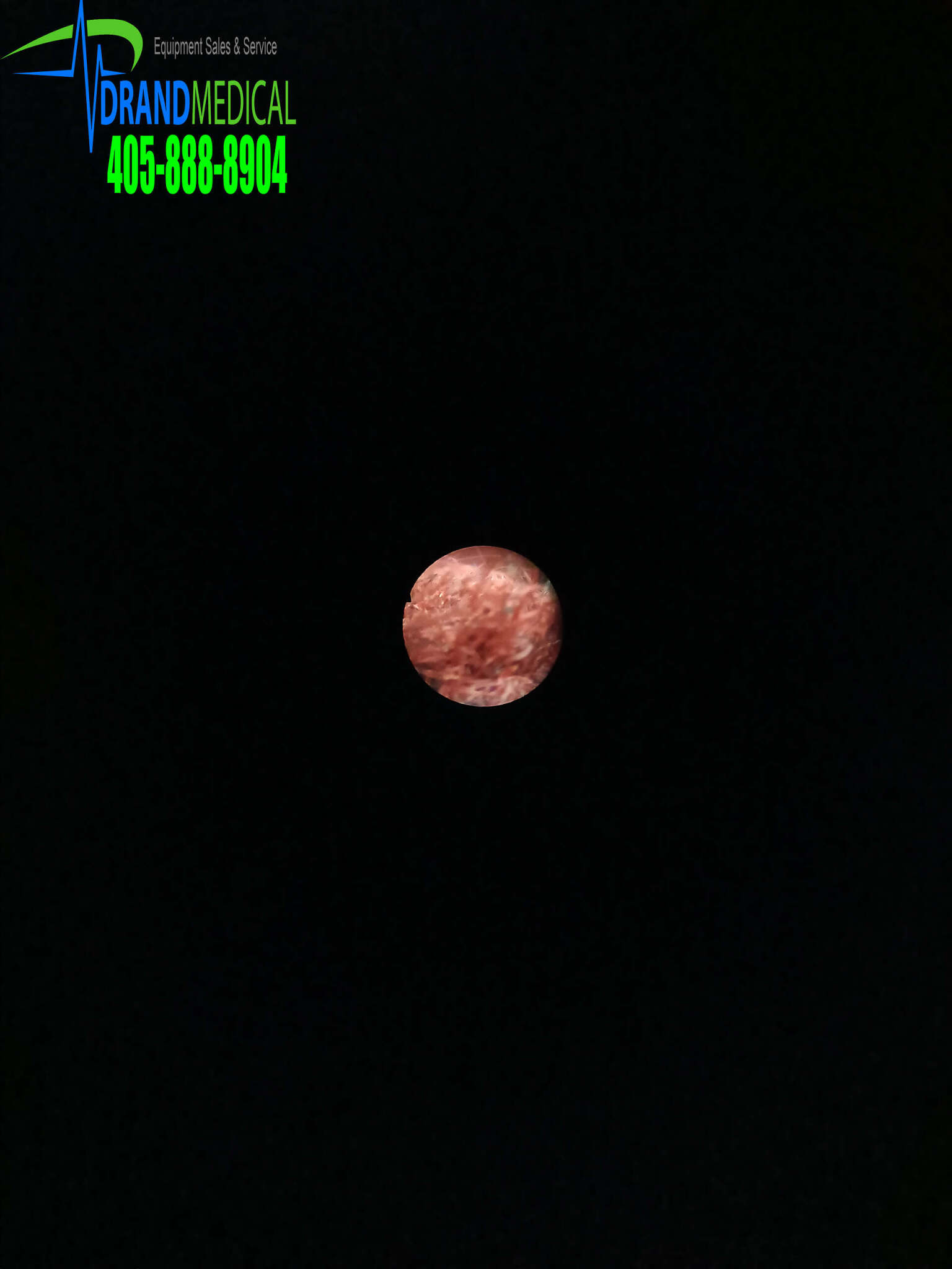 OLYMPUS A4674A 30 degrees Rigid Hysteroscope - Medsold