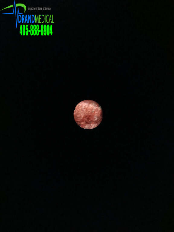 OLYMPUS A4674A 30 degrees Rigid Hysteroscope - Medsold