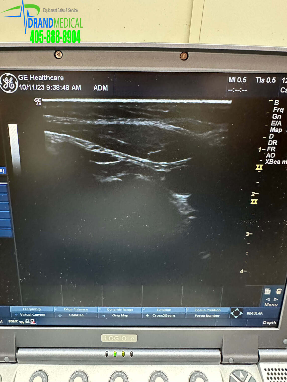 GE Logiq E Ultrasound System With 1 Probe 12L and Docking Cart - Medsold