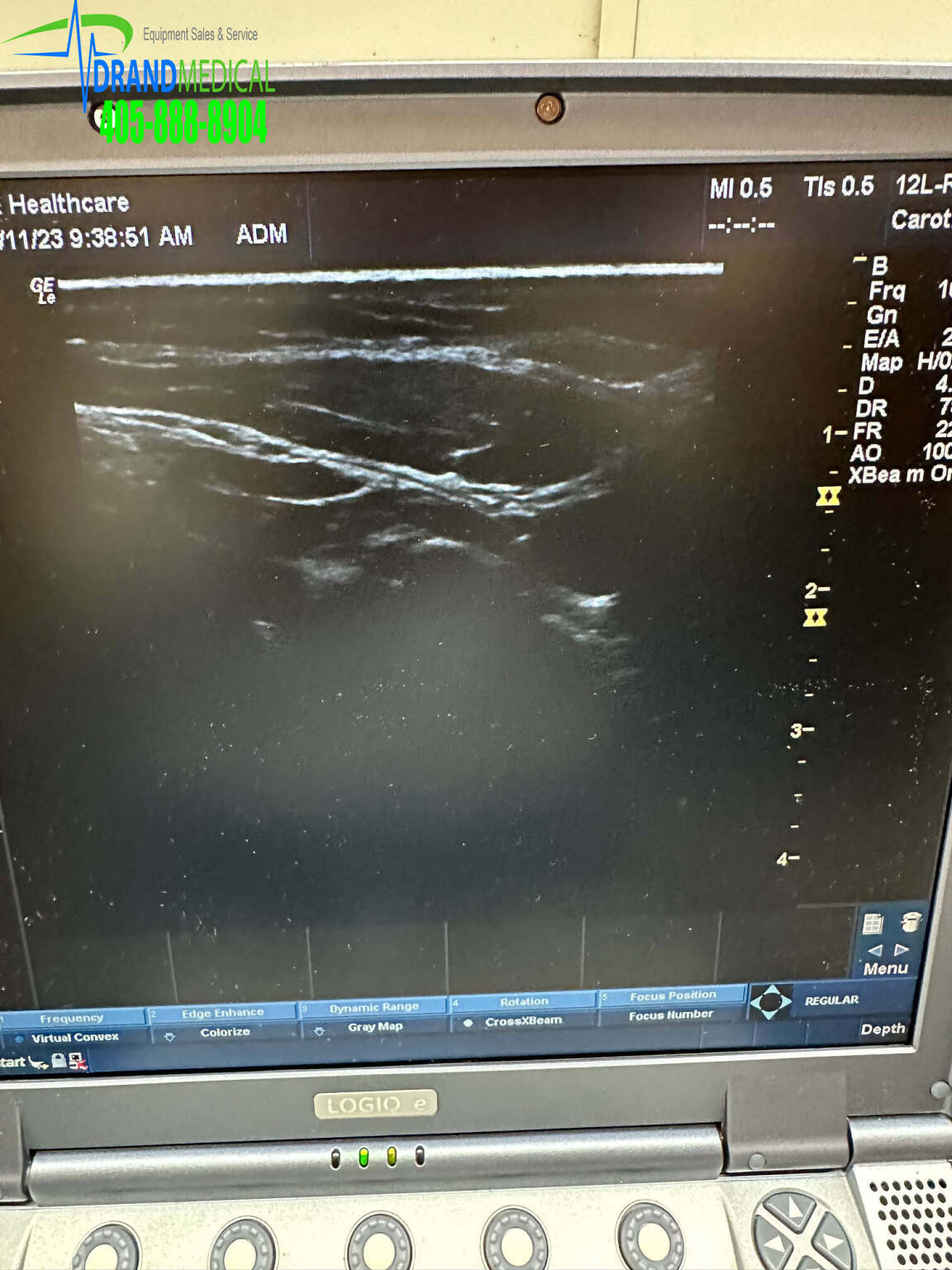 GE Logiq E Ultrasound System With 1 Probe 12L and Docking Cart - Medsold